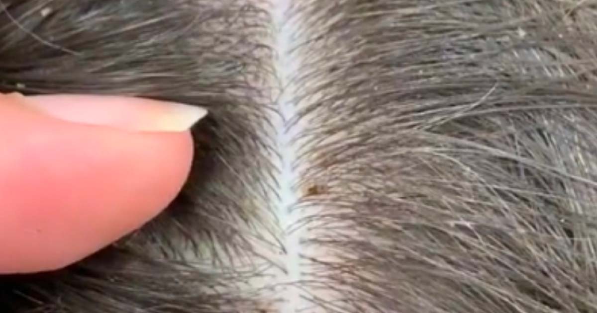 Žena se chtěla nechat ostříhat. Z vlasů se kadeřnici udělalo zle