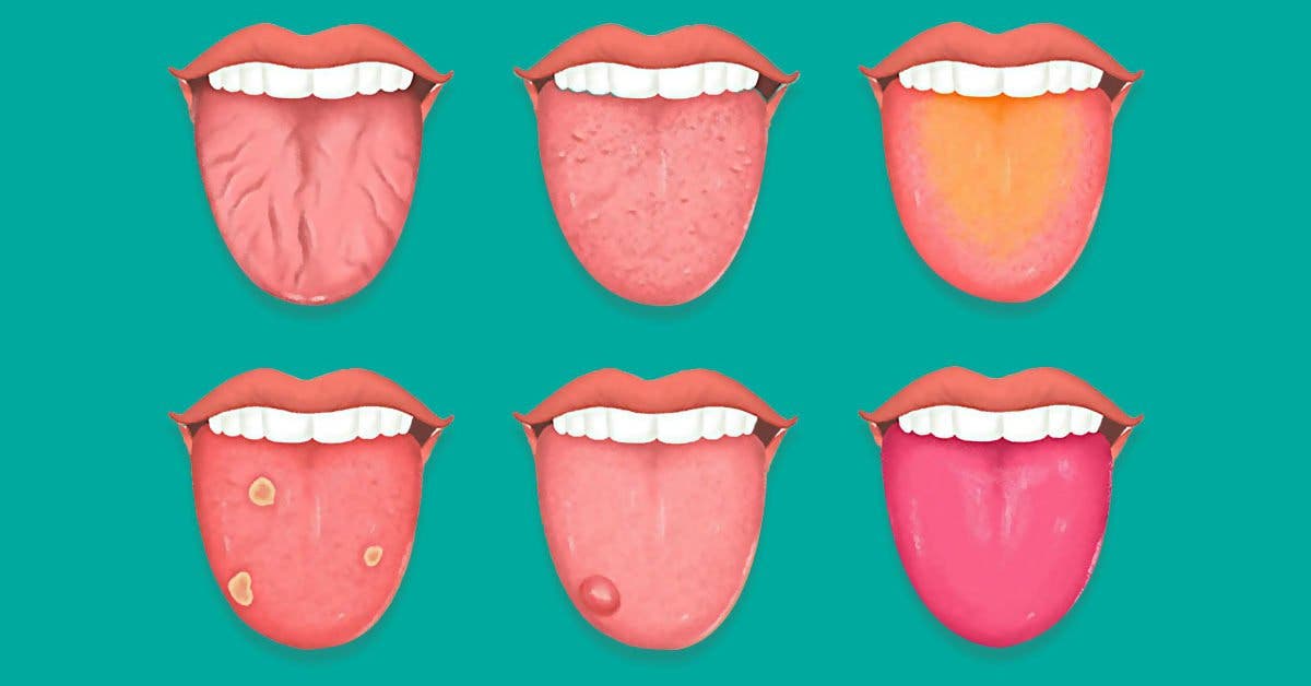 Co prozradí barva jazyka o vašem zdraví? | Světkreativity