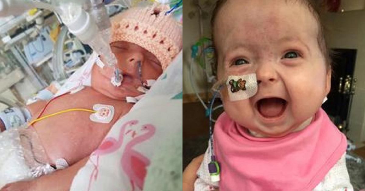 Od narození má nemoc, kvůli které rychle stárne