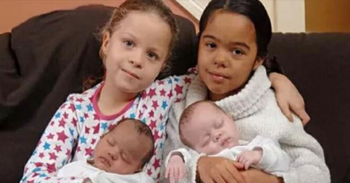 Žena porodila dvojčata s rozdílnou barvou pleti | Světkreativity