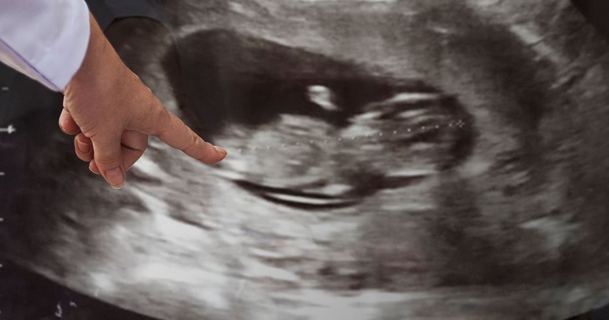 Varovné snímky ultrazvuku zmátly budoucí matku i zkušené doktory