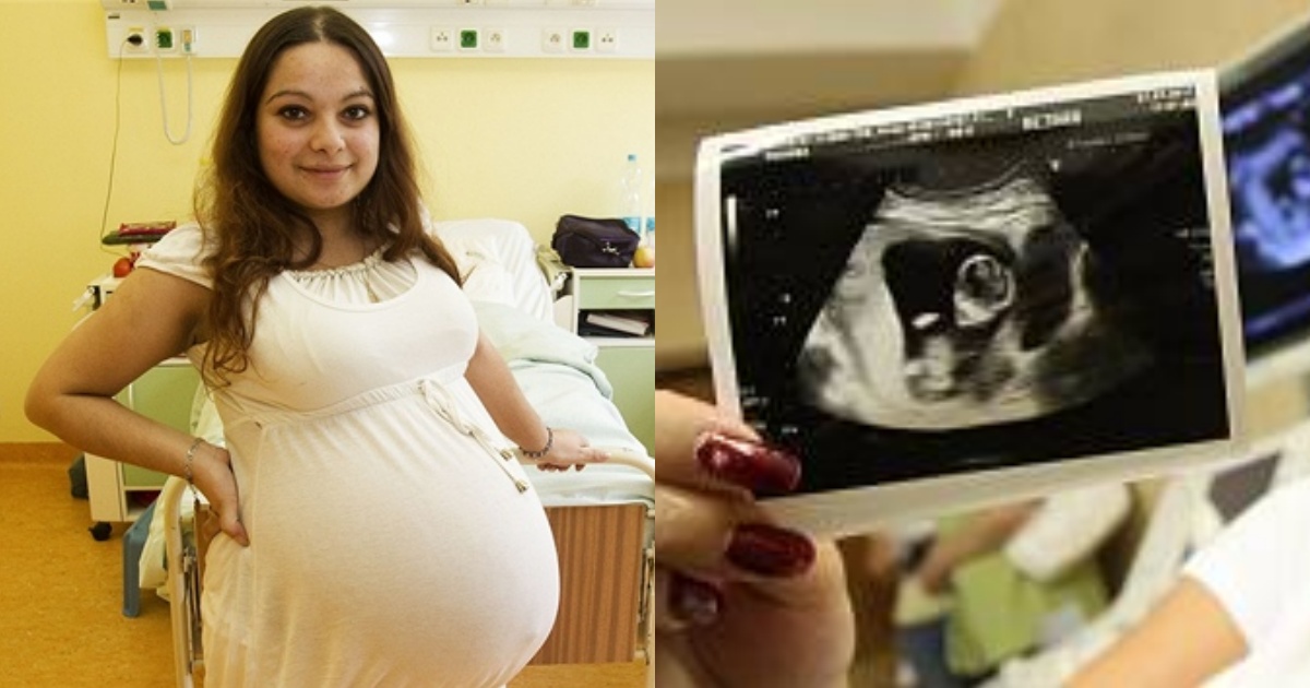 Vzácný případ těhotenství (1 ze 45 000 000) doktory zcela vykolejil