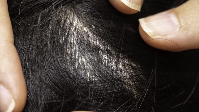 Kadeřnice rozhrnula vlasy chlapečka a zhrozila se nechutností